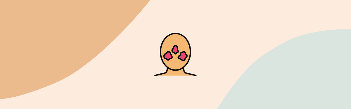 Rosacée du visage (couperose) : reconnaître et traiter