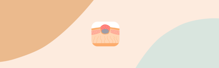 Bouton sur le pénis : causes, IST, comment l’enlever